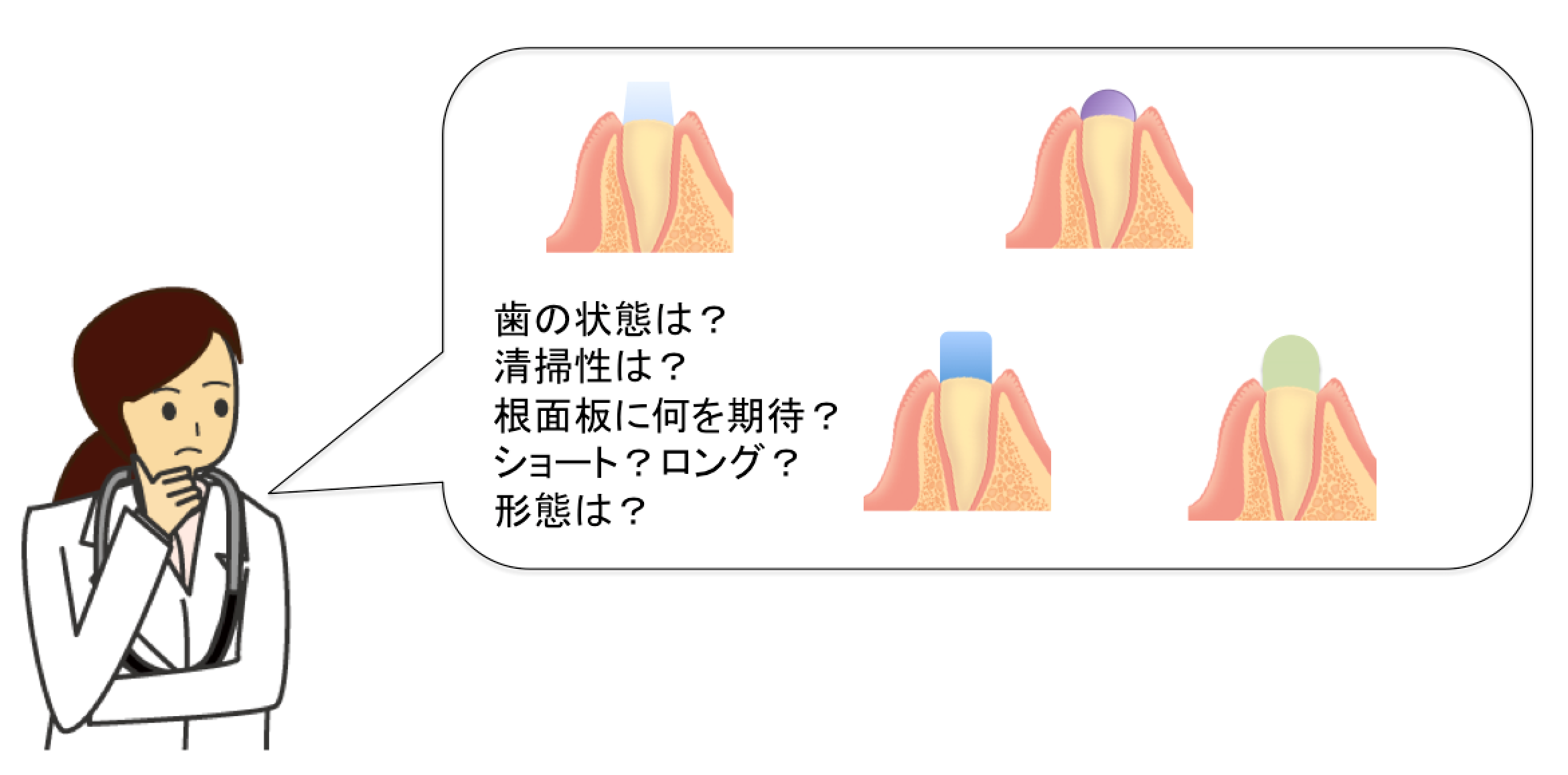 入れ歯について知ろう−その72−根面板のデザイン｜吹田市寿町の歯医者｜よしなか歯科クリニック